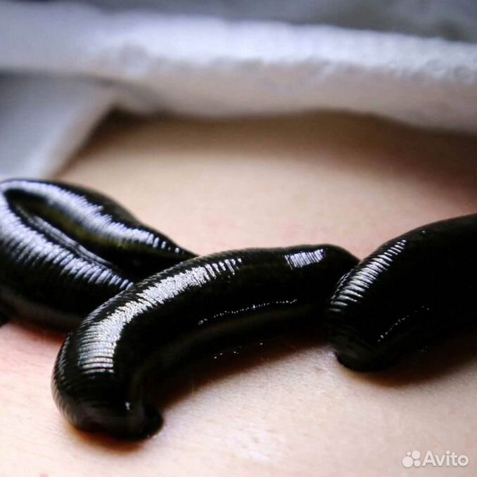 Пиявка лечебная