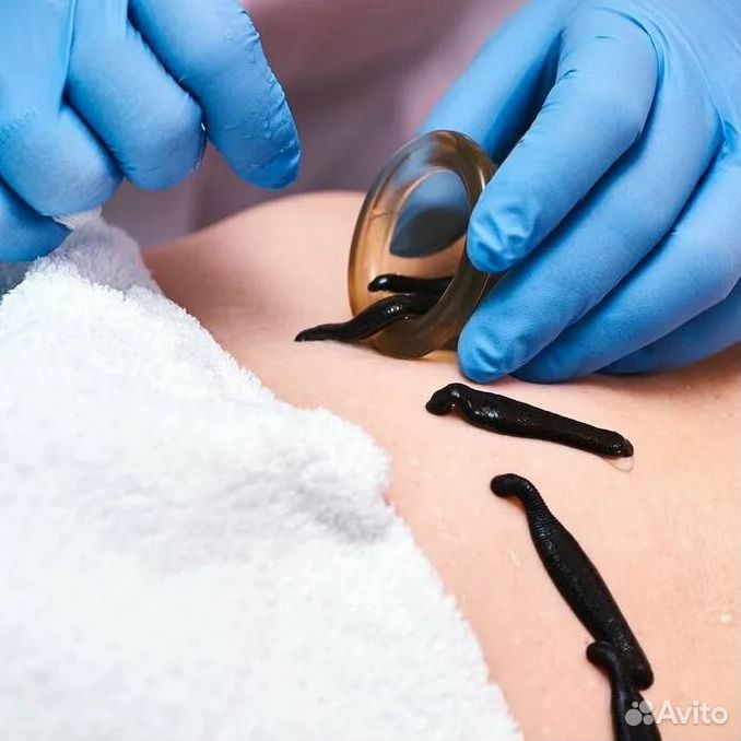 Пиявки сертифицированные доставка самовывоз